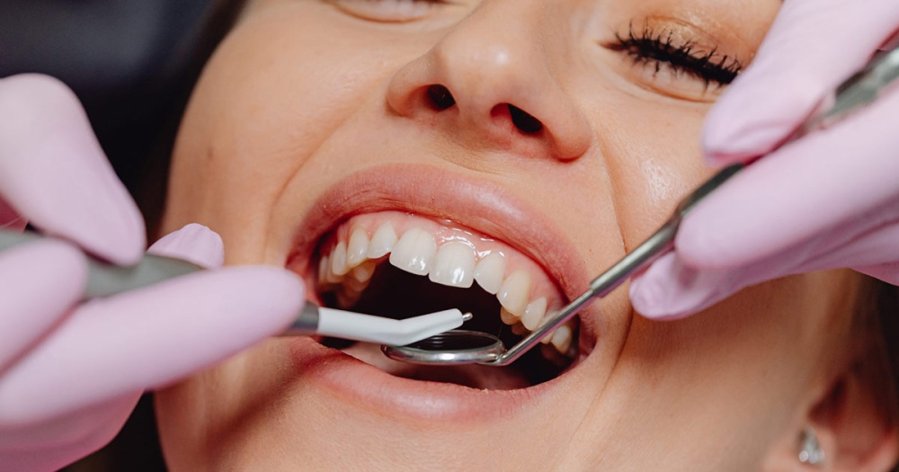 Phục hình răng | Trung Tâm Nha Khoa Thẩm Mỹ Toàn Cầu